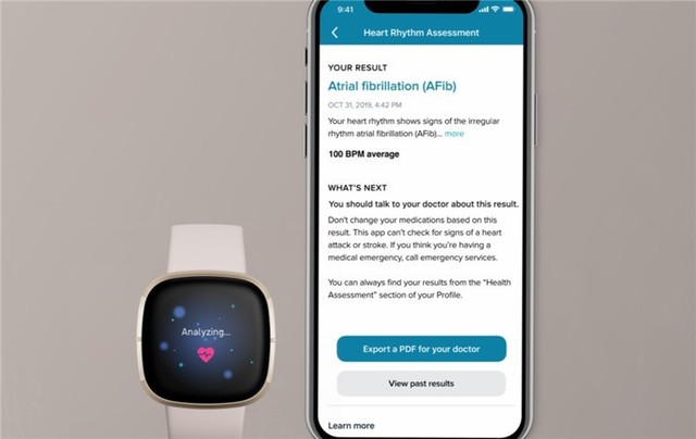 将运动进行到底！3款Fitbit可穿戴新品-中关村在线头条